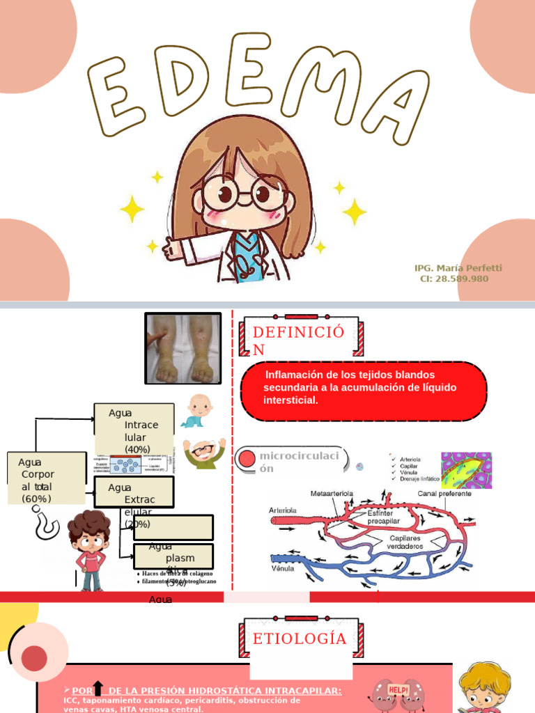 Sindrome Edematoso | PDF | Edema | Medicina CLINICA