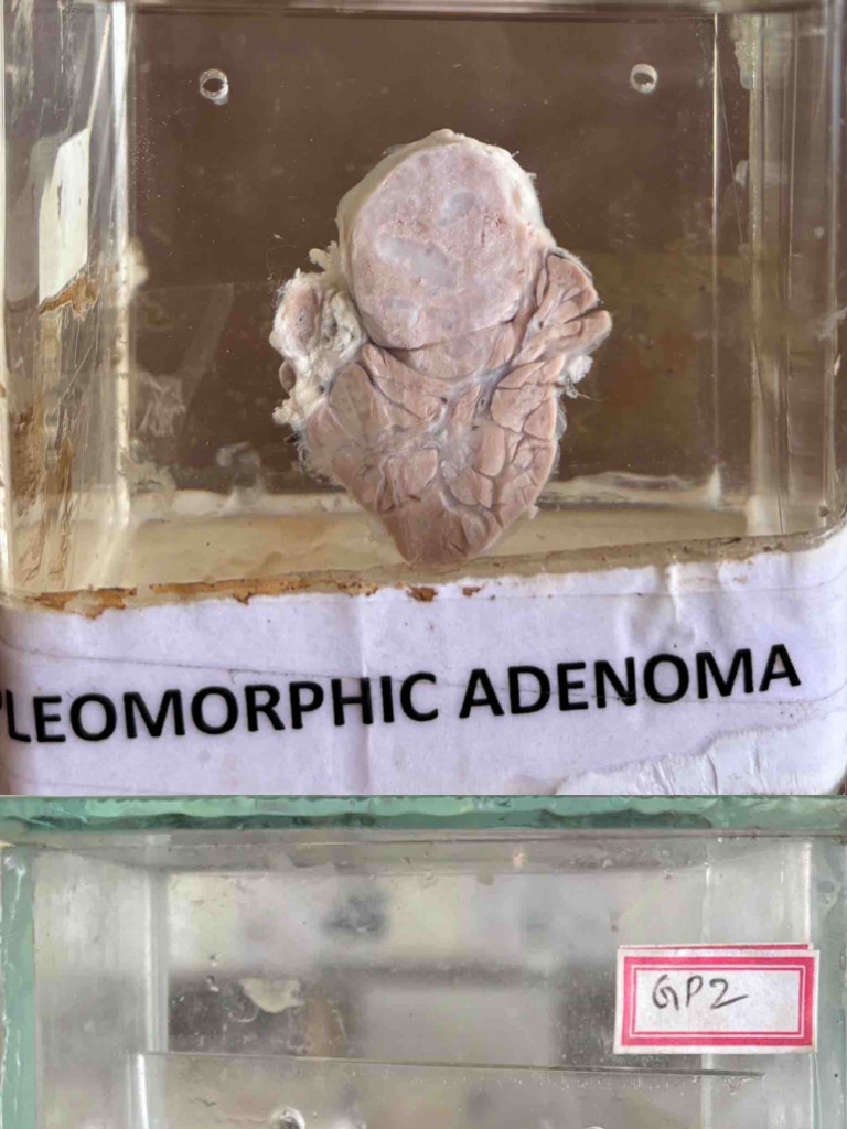 Gross Specimens | PDF