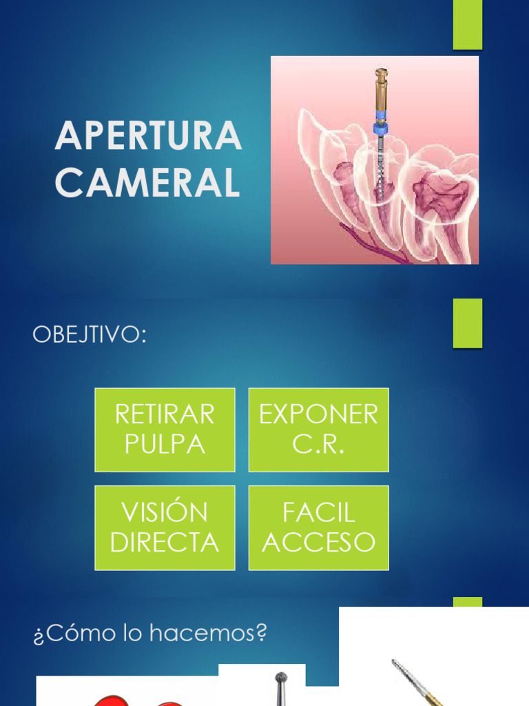 Apertura Cameral | PDF