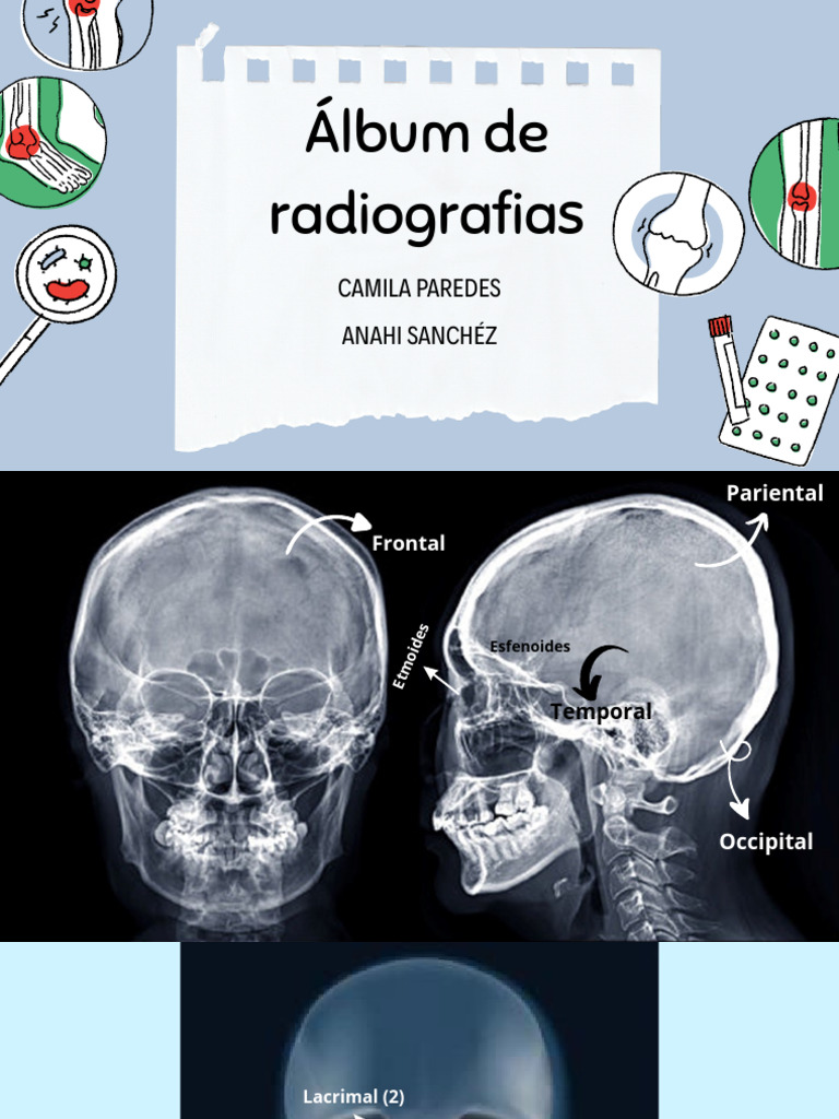 Album de Radiografias | PDF