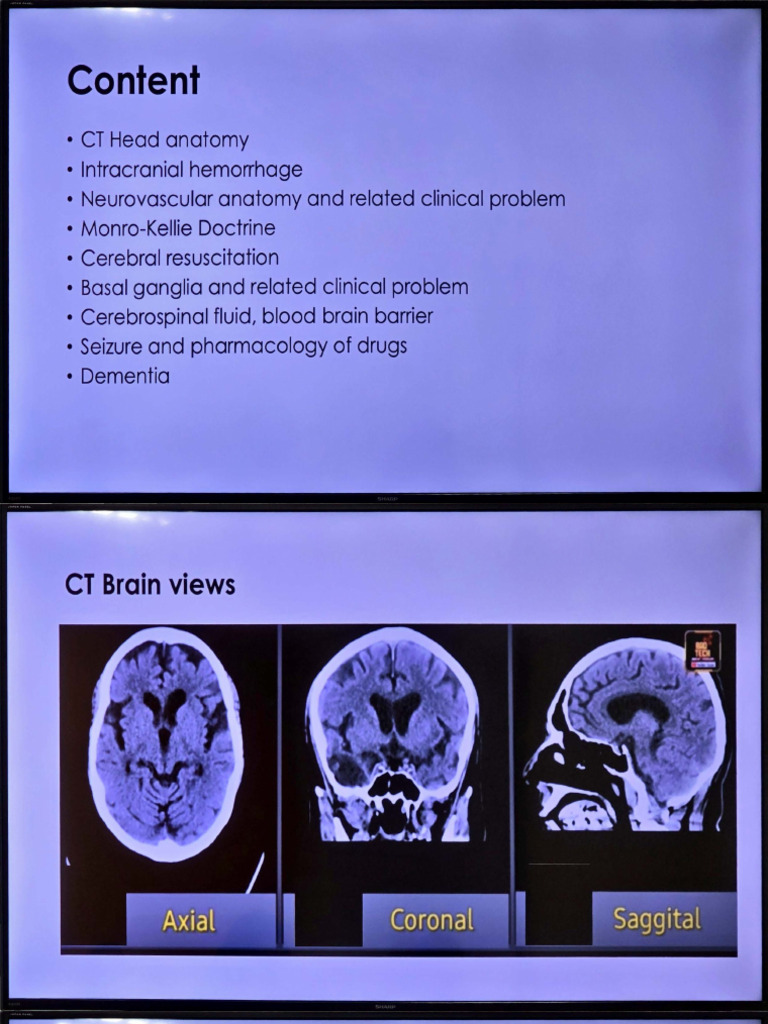 CNS[1] | PDF | Neuroscience | Physiology