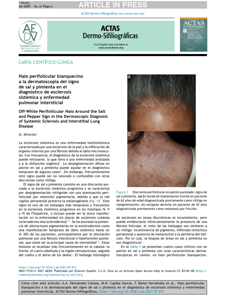 Halo Blanquecino en Dermatoscopia de Esclerosis | PDF | Reumatología ...