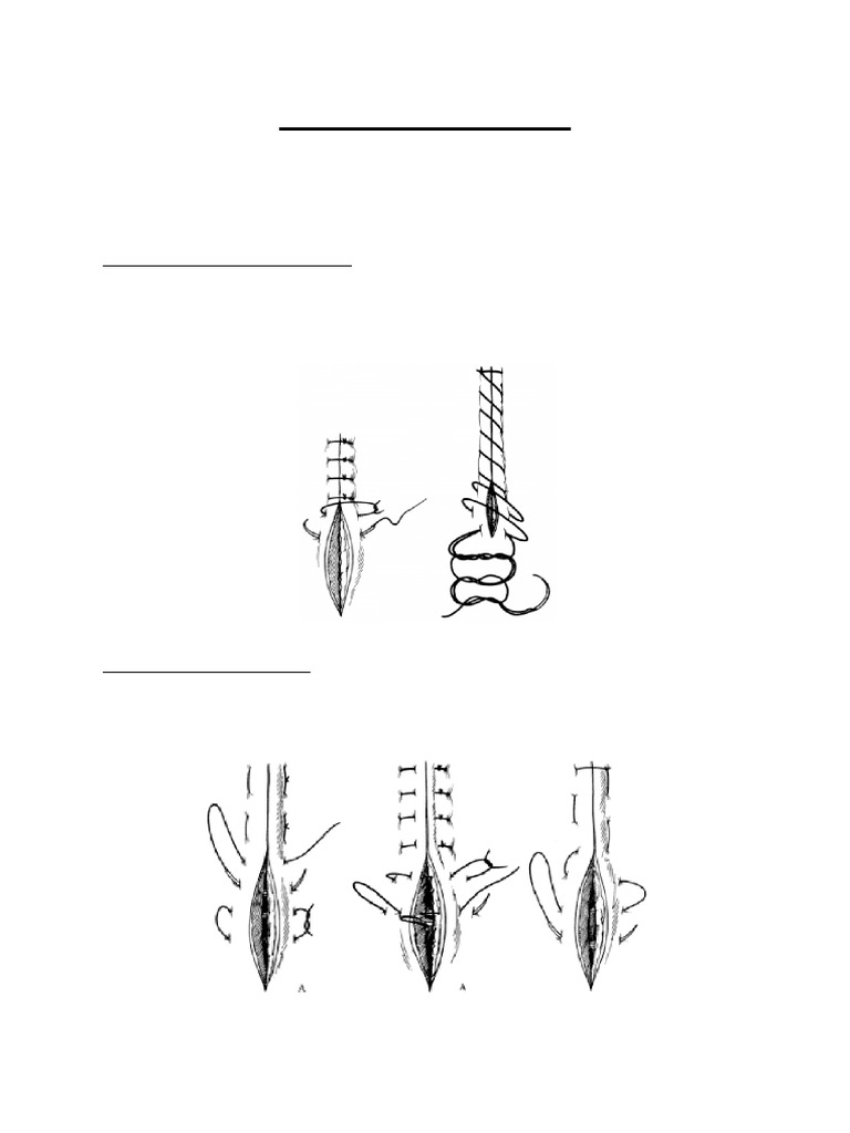 Overview of Suture Patterns | PDF | Surgical Suture | Surgery