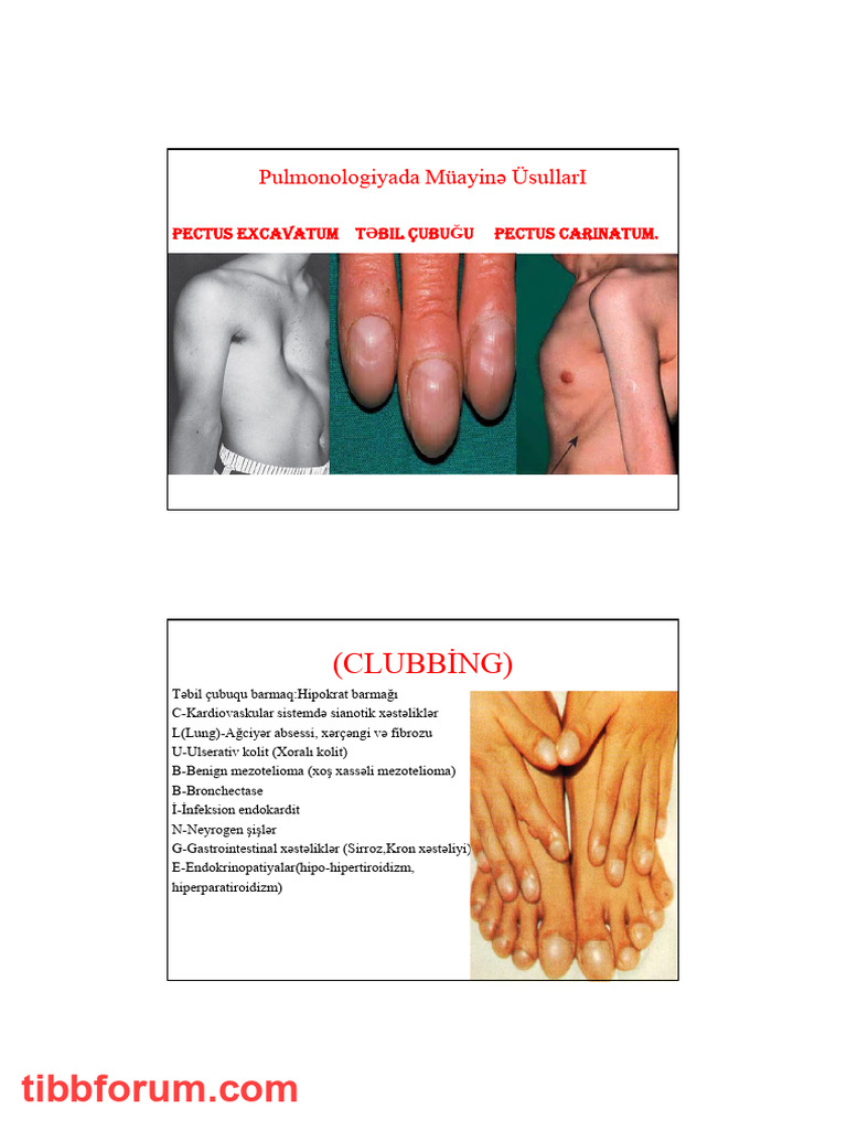 Tibbforum - Com - Pulmon Müayine Lek 1 | PDF