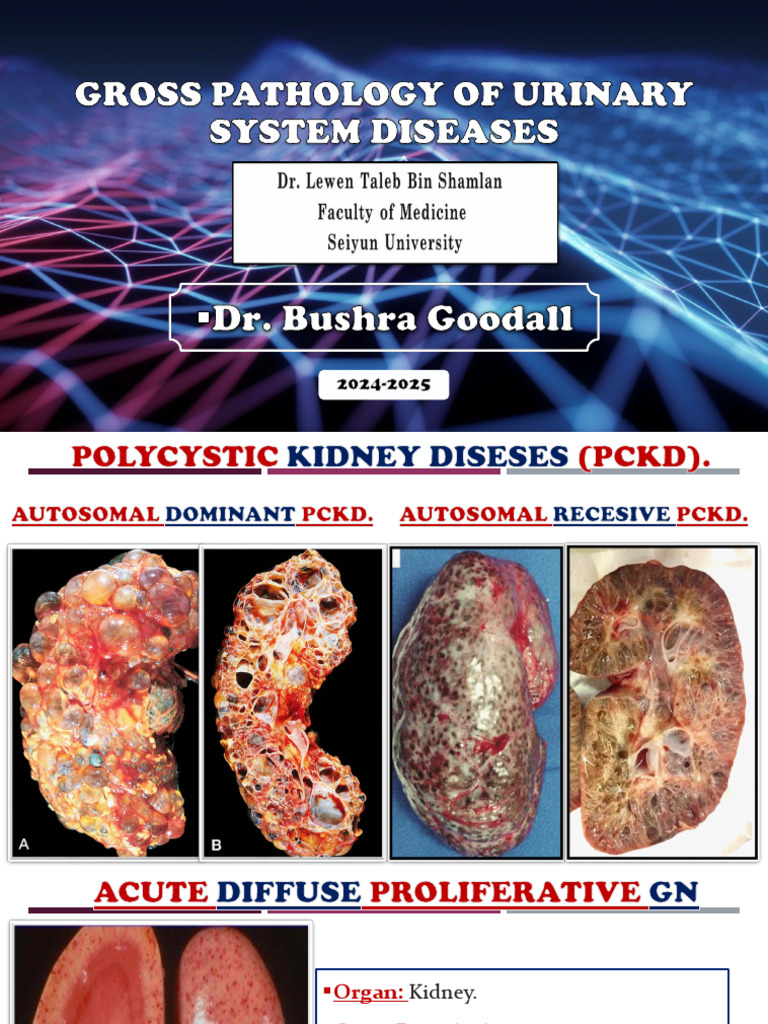 Urinary System Diseases: Gross Pathology | PDF | Kidney | Kidney Disease