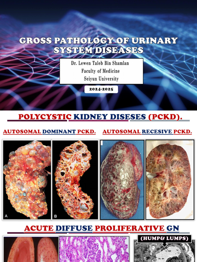 Urinary Dis. (Gross) | PDF