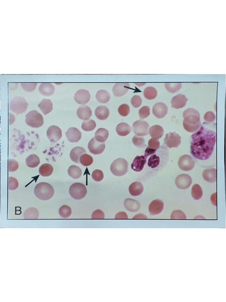 CLIP Cytology Charts | PDF