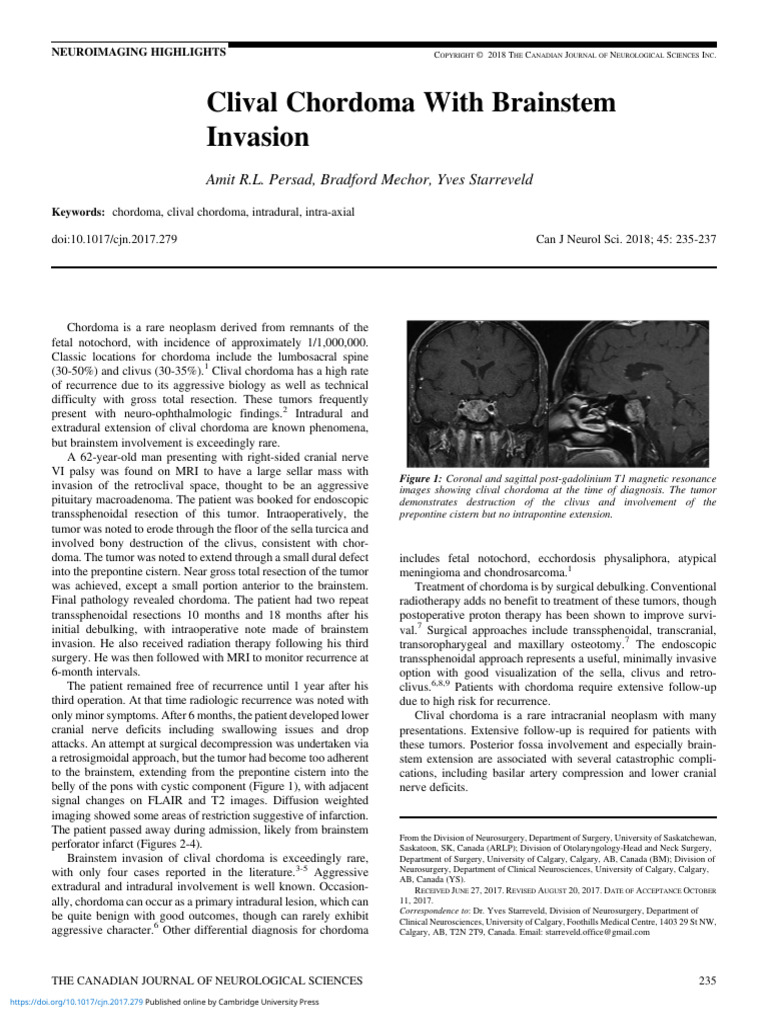 Clival Chordoma With Brainstem Invasion | PDF | Brain Tumor | Magnetic ...