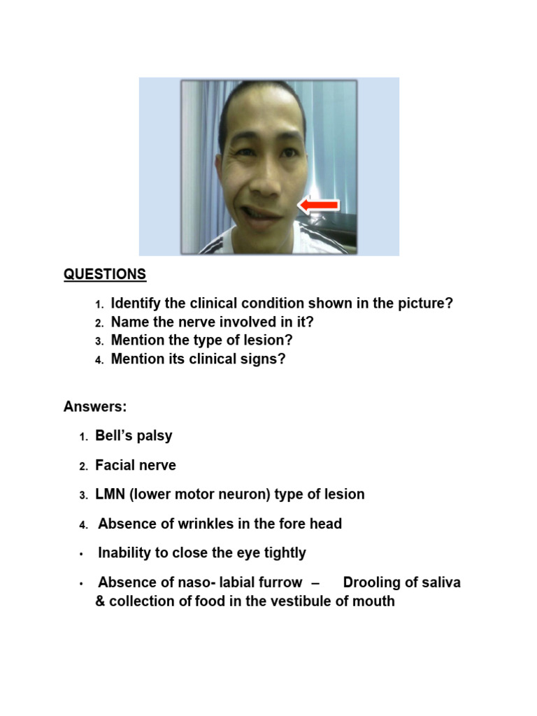 Clinical Conditions and Nerve Involvement | PDF | Thyroid | Human Head ...