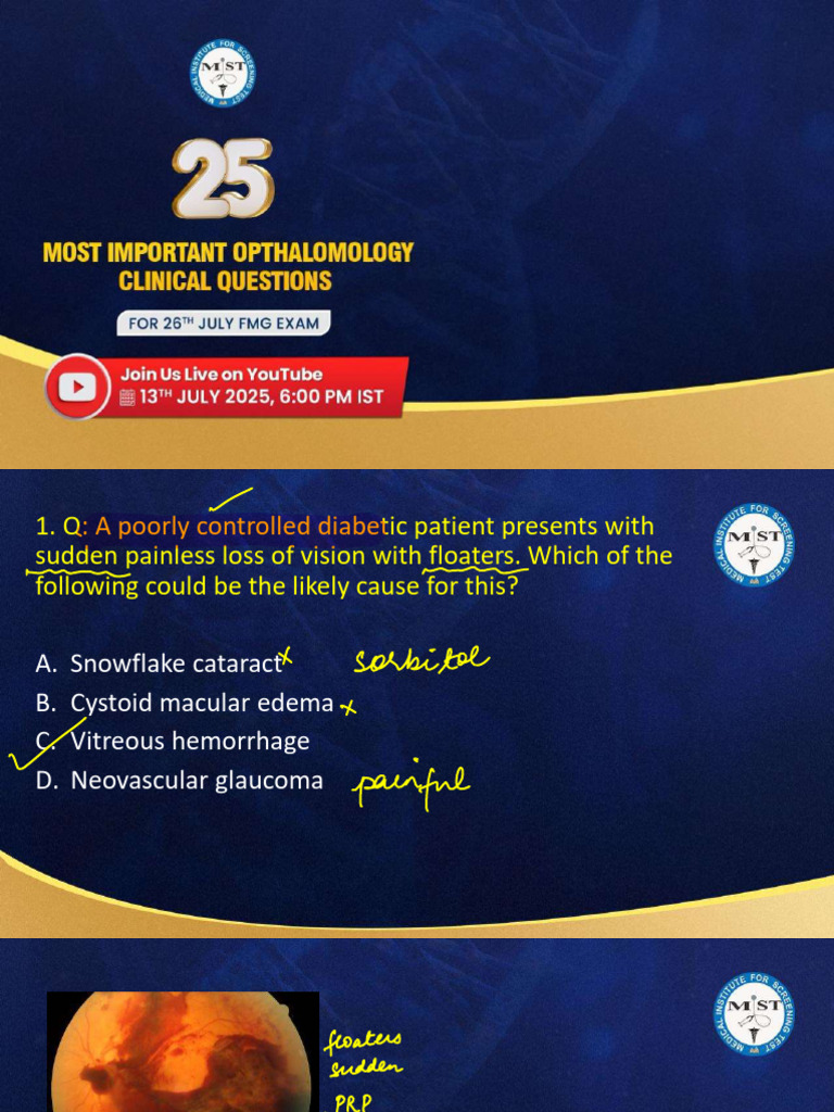 MIST, Ophthalmology 25 Most Imp Question PDF | PDF | Cataract | Glaucoma