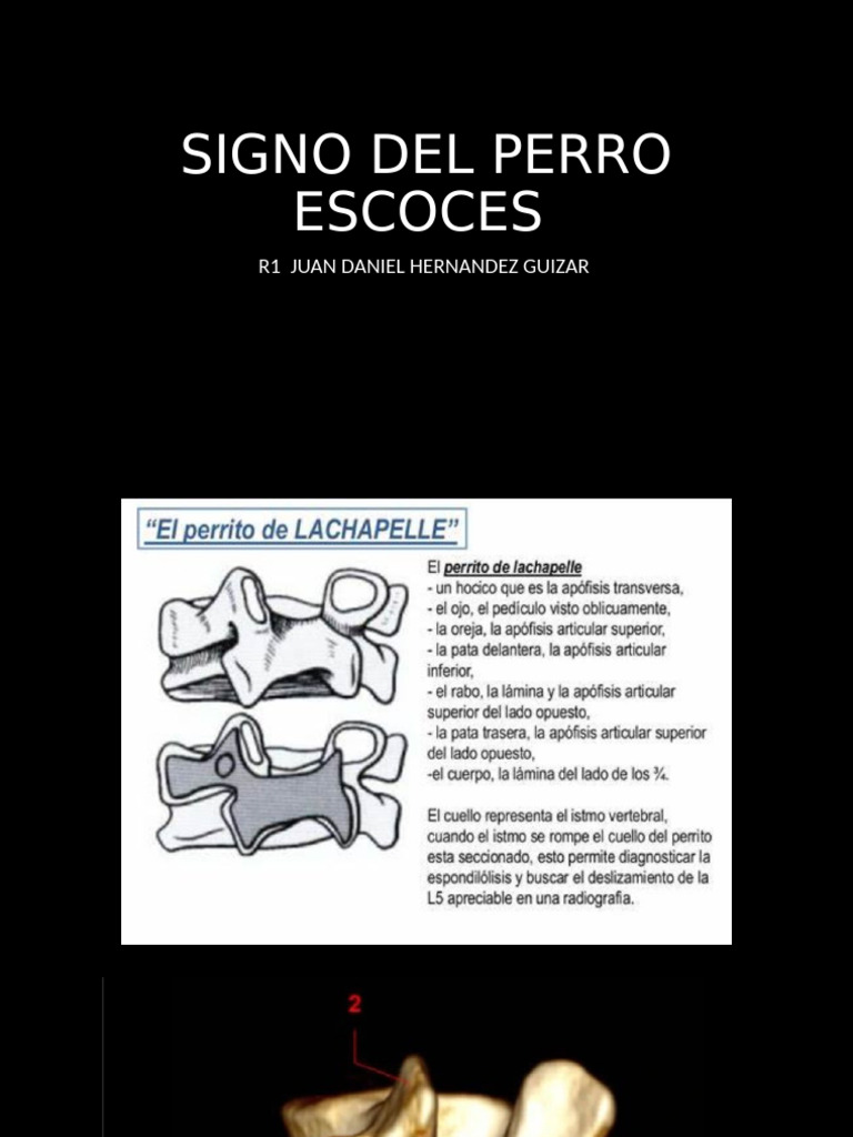 Signo Del Perro Escoces | PDF
