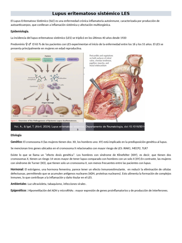 Lupus Eritematoso Sistémico Guía Completa Pdf Enfermedades Y