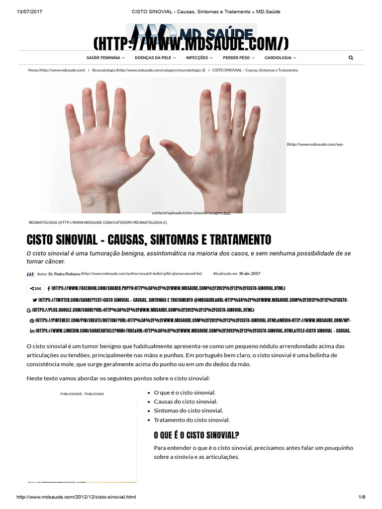 Cisto Sinovial: Causas e Tratamento | PDF | Osteoartrite | Esqueleto