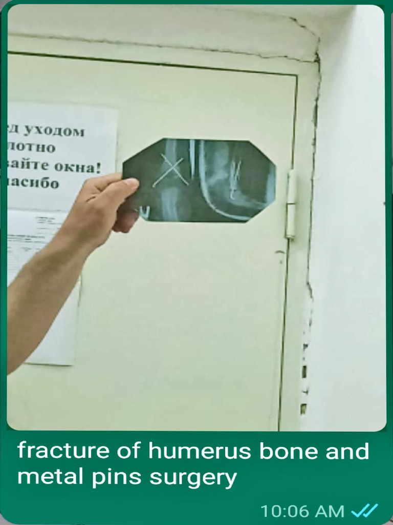 Surgery X-Ray | PDF