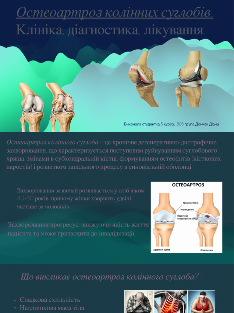 Osteoartroz Kolinnix Suglobiv | PDF