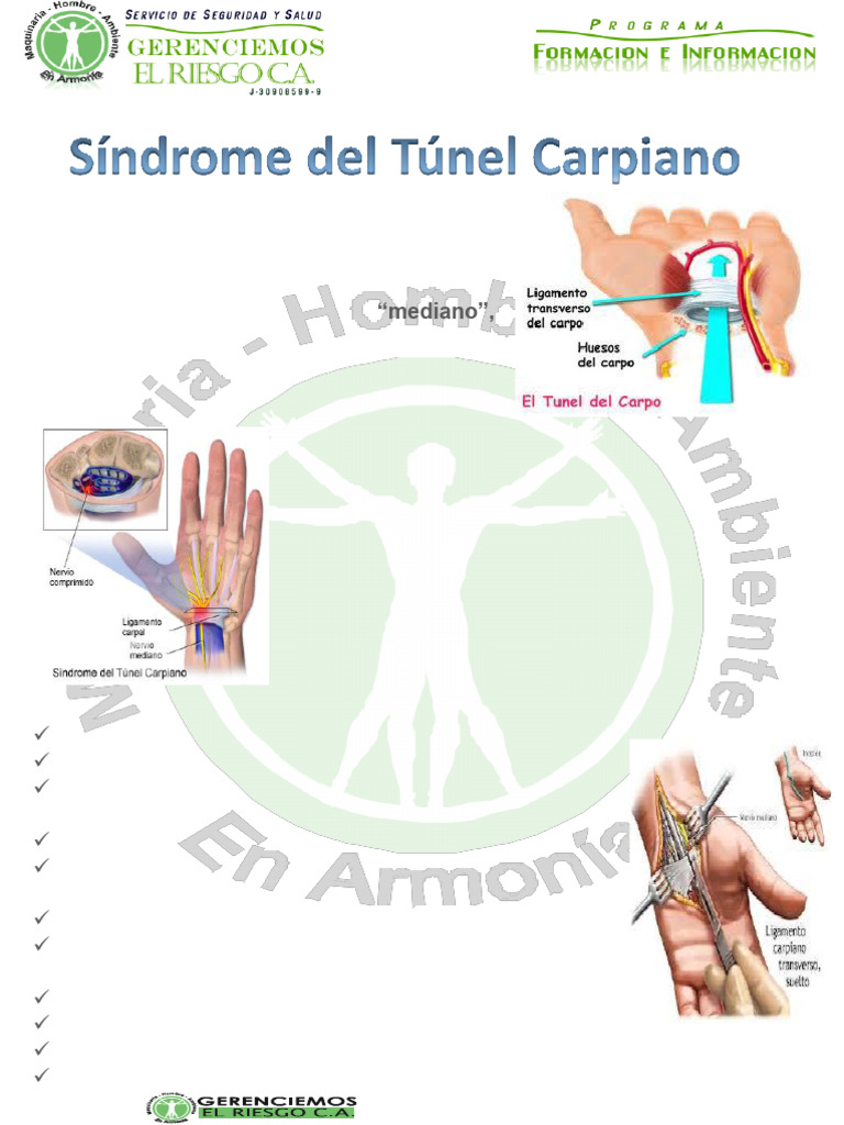 Sindrome Del Tunel Carpiano | PDF | Síndrome del túnel carpiano | Mano
