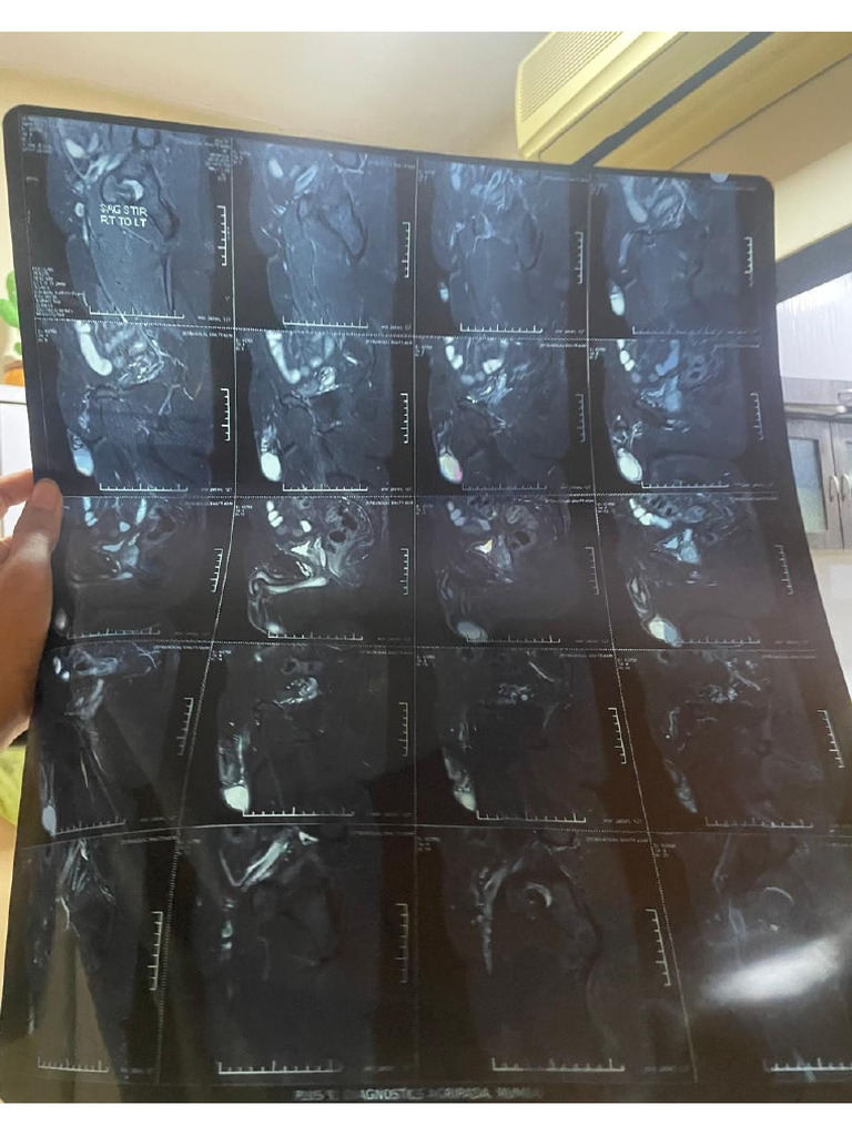 Image To PDF 20250718 21.50.28 | PDF