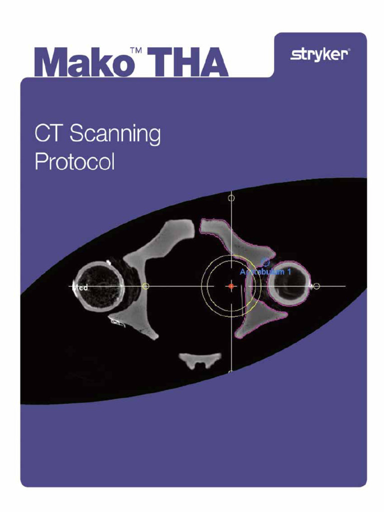 Anexo II - Mako THA CT Scanning Protocol | PDF | Pelvis | Knee