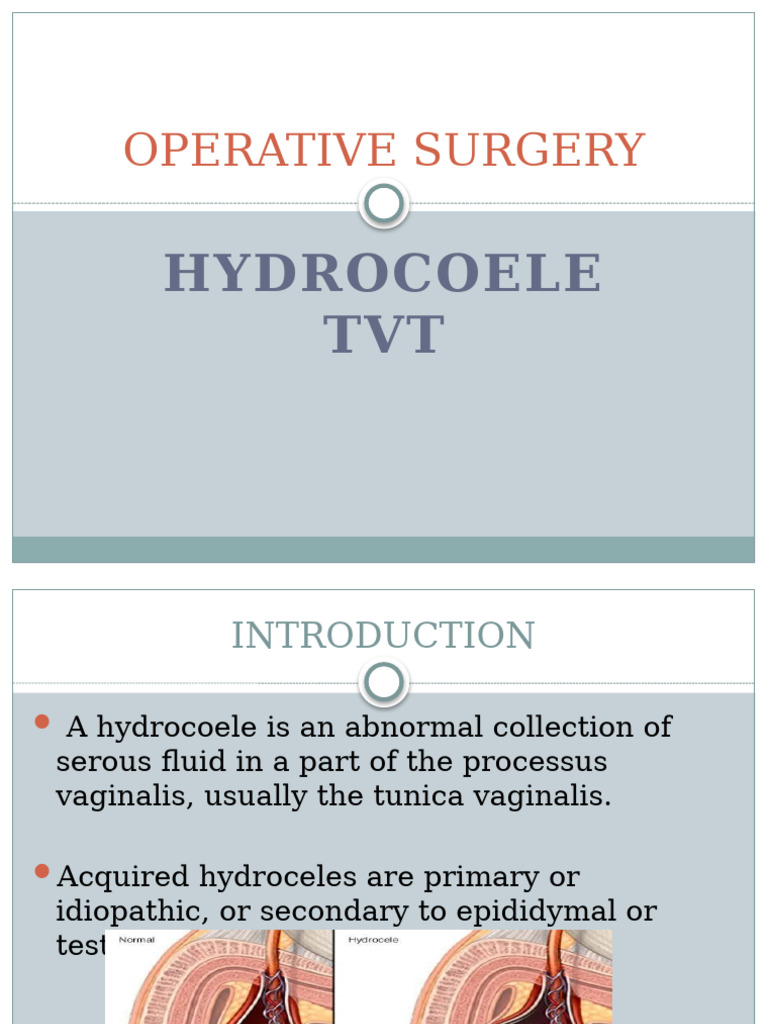 Hydrocele Surgery: Jaboulay vs Lord's | PDF