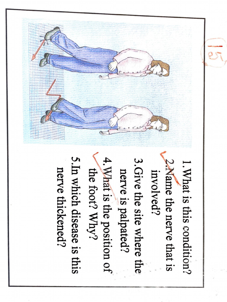 Anatomy OSPE Charts | PDF