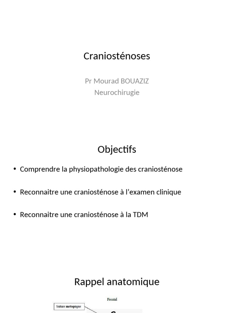 Craniosténoses : Diagnostic et Types | PDF | Anomalie congénitale ...