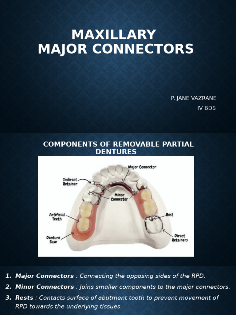Maxillary Major Connectors in RPDs | PDF | Dentistry Branches
