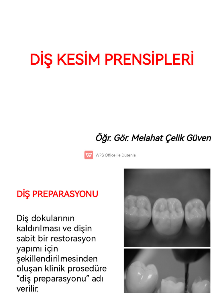 Ders Diş Kesim Prensipleri | PDF