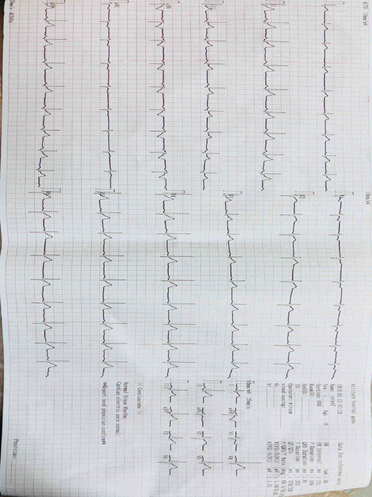 ECG 08 July 25 Divij | PDF