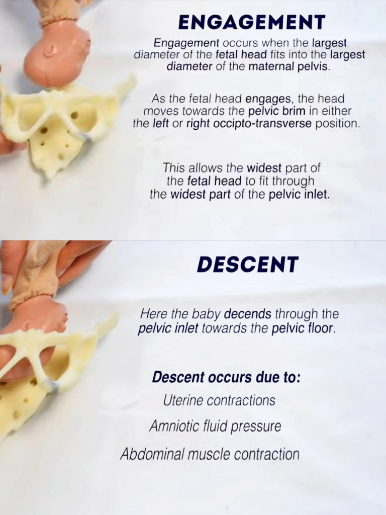Delivery | PDF | Pelvis | Childbirth