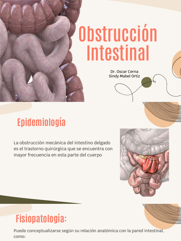 Obstrucción Intestinal - Sindy O | PDF | Medicina CLINICA ...