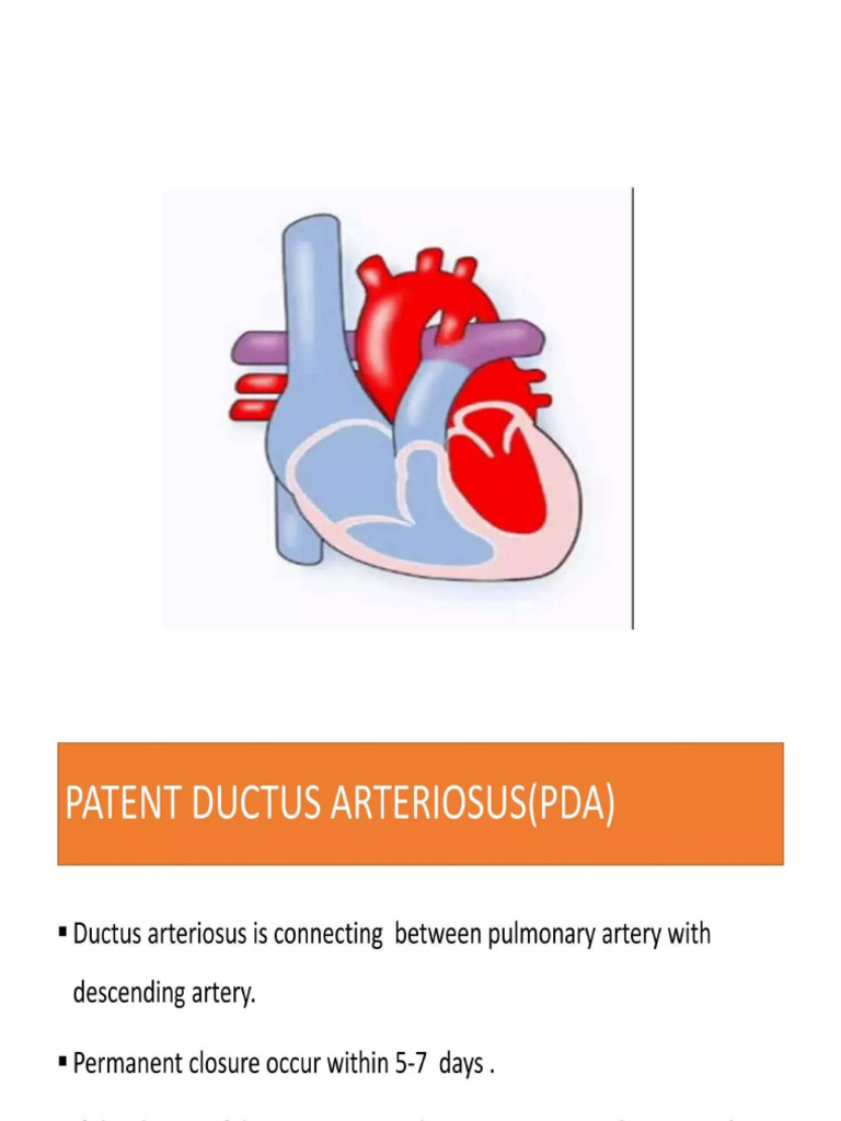 PDA | PDF