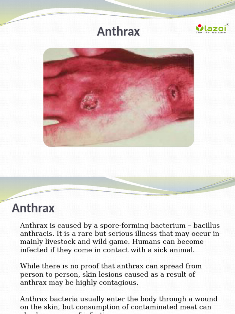E683604D-Anthrax | PDF | Anthrax | Human Diseases And Disorders