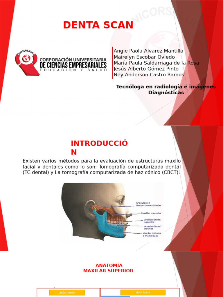 Exposicion Denta Scan 1.0 | PDF | Odontología | Ct Scan