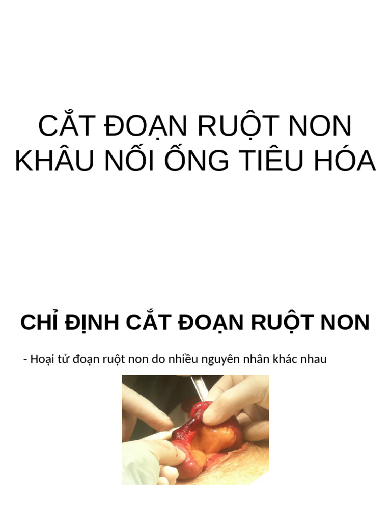 Cat Doan Ruot Non - Khau Noi Ong Tieu Hoa | PDF