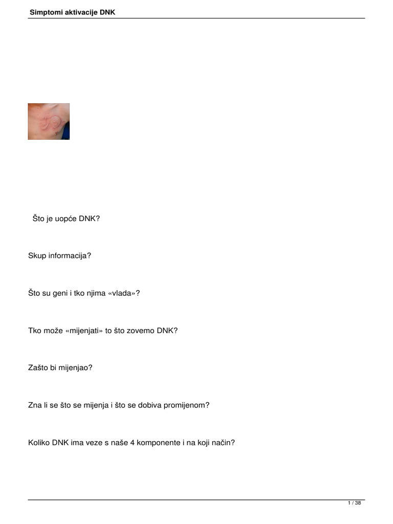 Simptomi Aktivacije DNK | PDF