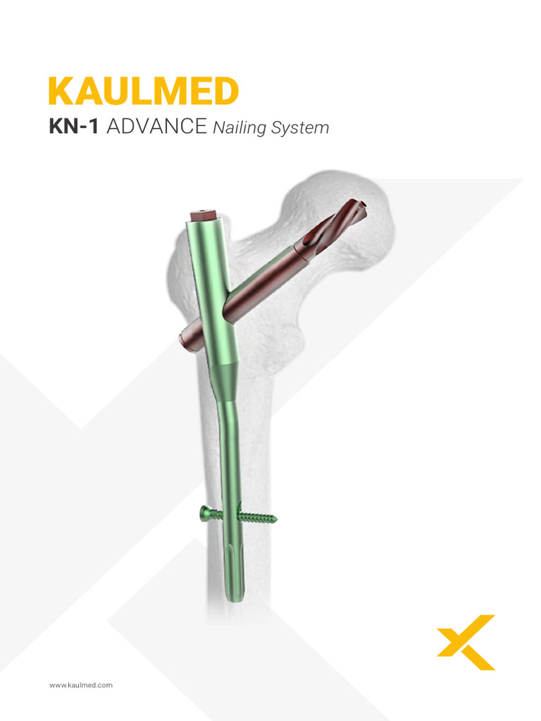 KN-1 Advance Nailing System Overview | PDF | Screw | Drill