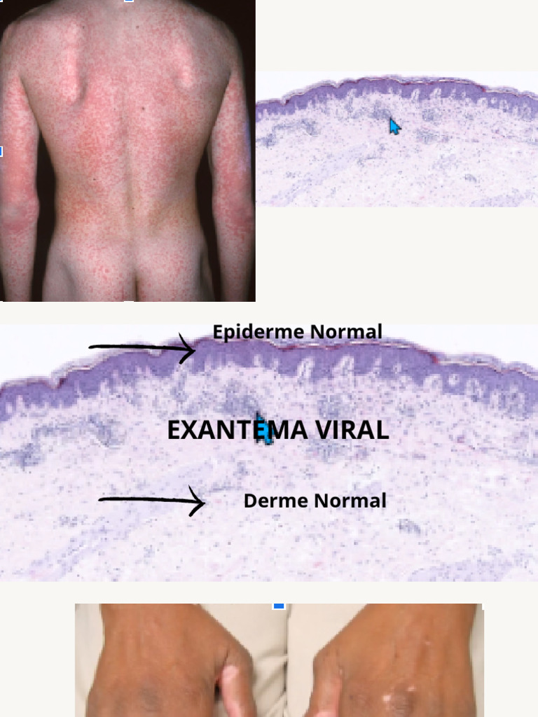 Simulado Dermato | PDF | Pele | Sistema tegumentar