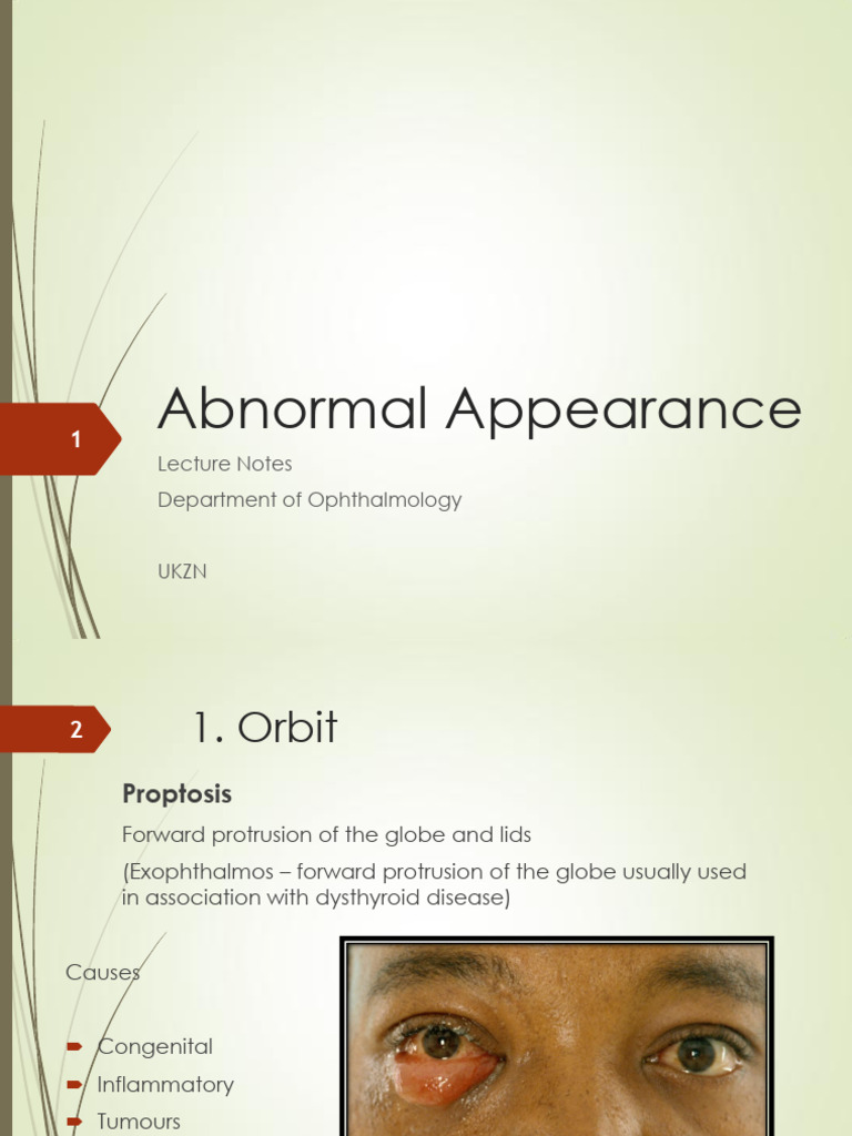Lecture - Abnormal Appearance of The Eye | PDF | Medical Specialties ...