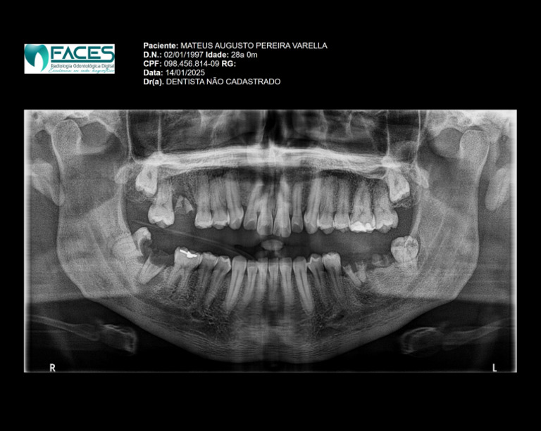 Mateus Augusto Pereira Varella Panoramica | PDF