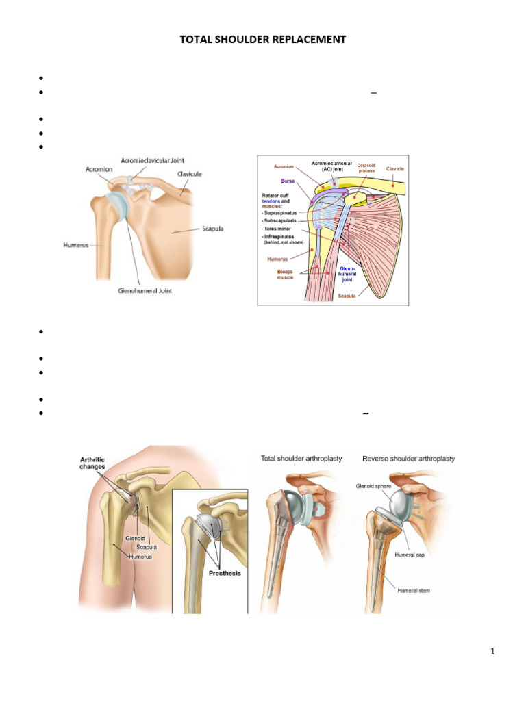 Total Shoulder Replacement Guide | PDF | Anatomical Terms Of Motion ...