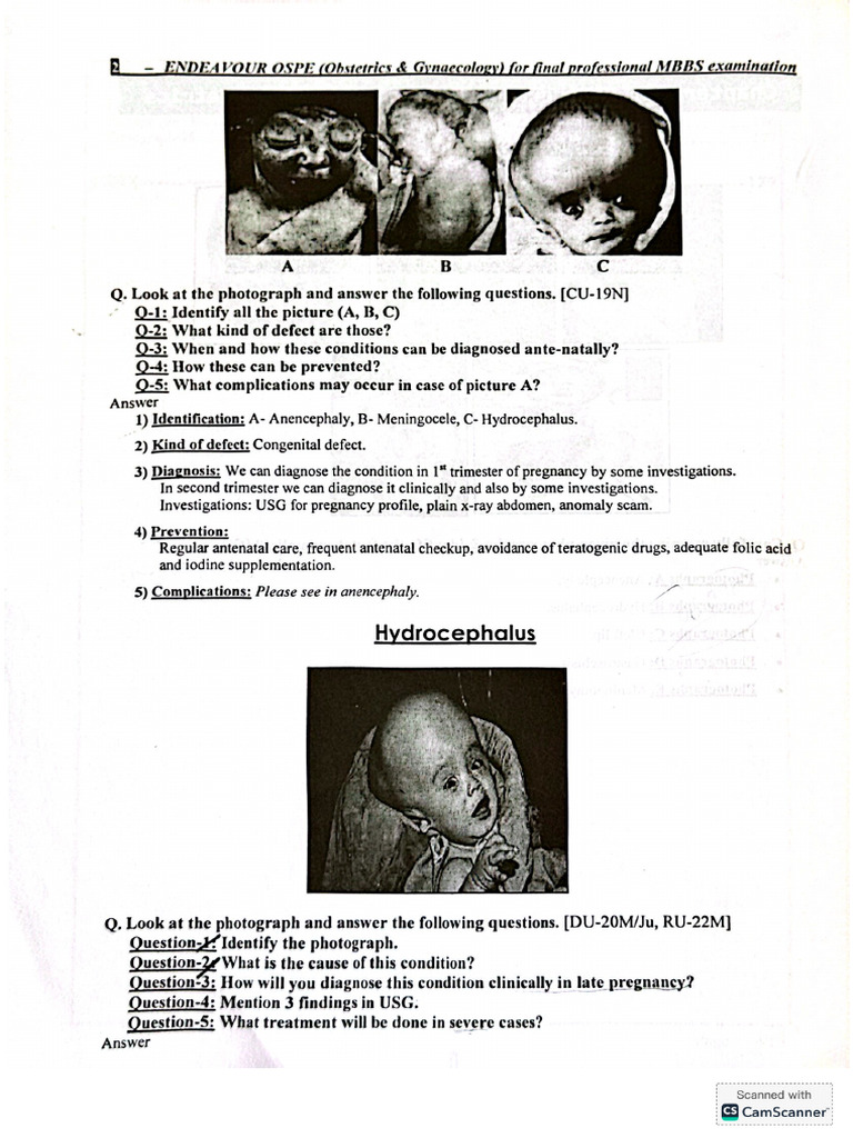 Gyne Ospe (DU-upto May23) | PDF