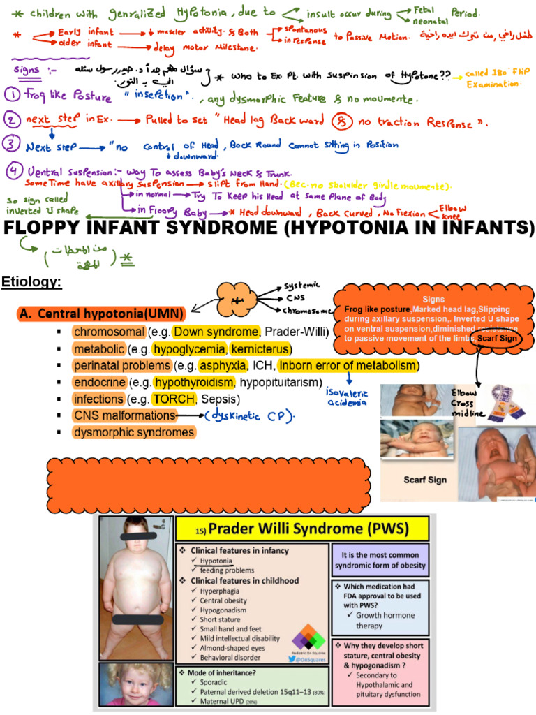 Hypotonia Approach | PDF