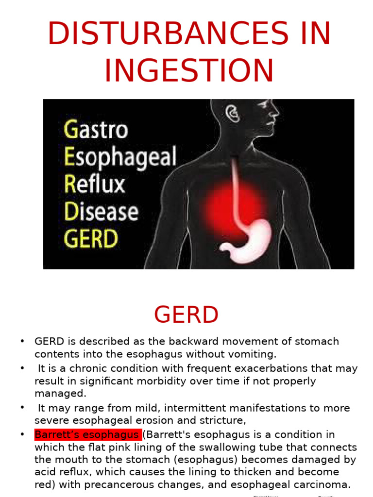 Understanding GERD and Hiatal Hernia | PDF | Gastroesophageal Reflux ...
