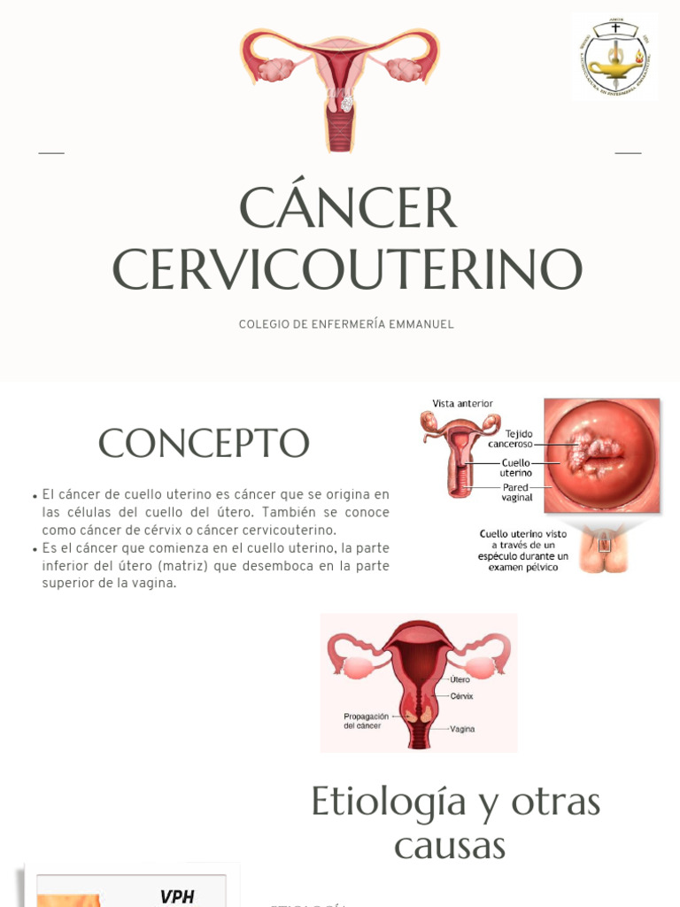 Cáncer Cervicouterino | PDF | Cáncer de cuello uterino | Ciencias de la ...