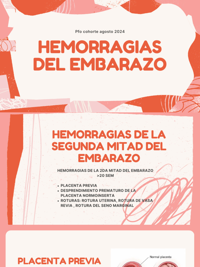 Hemorragias en la Segunda Mitad del Embarazo | PDF | El embarazo | Placenta