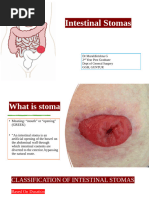Stamm Gastrostomy Procedure Steps | PDF | Surgical Suture | Medicine