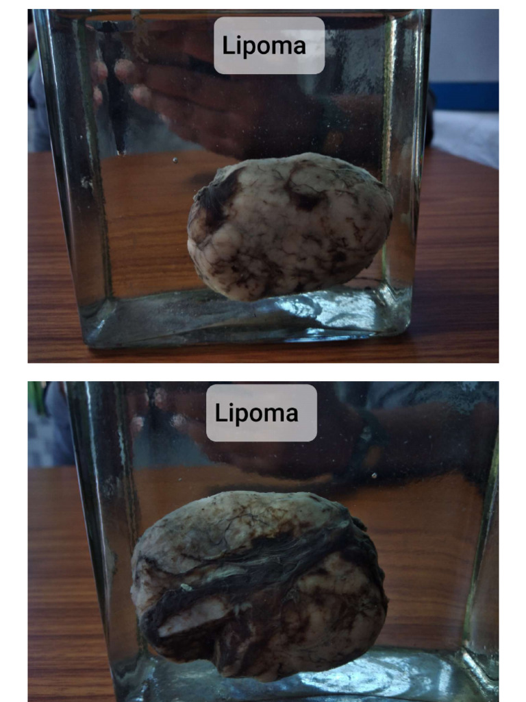 Surgery Specimen | PDF
