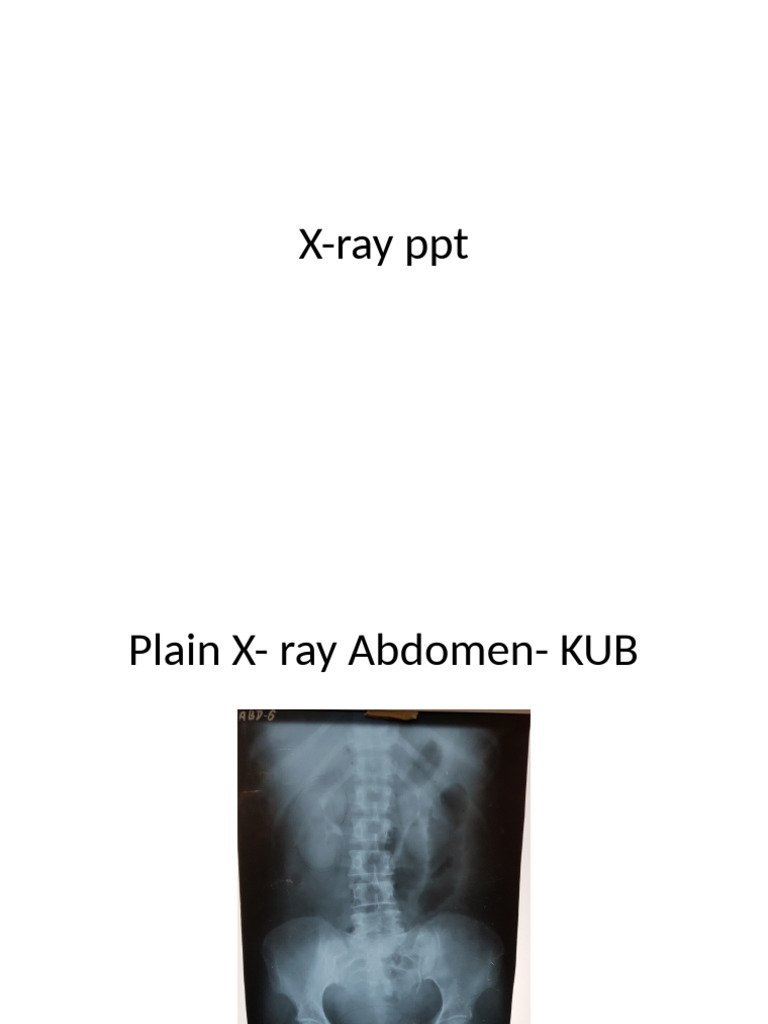X-Ray Chart Answers | PDF