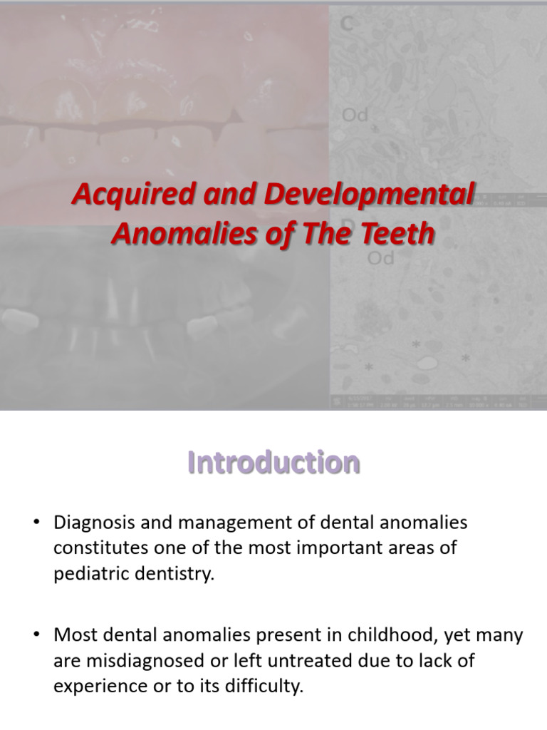 Dental Anomalies in Pediatric Dentistry | PDF | Human Tooth | Dental ...