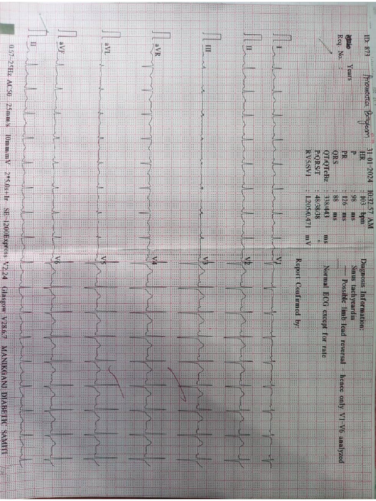 Ecg Report - 31.01.2024 | PDF